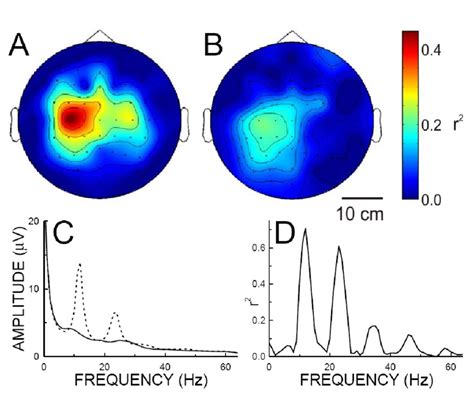 3 Ab Topographical Scalp Distribution Of The Difference Between