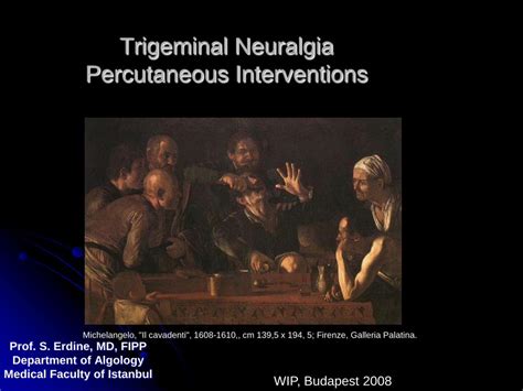 Pdf Trigeminal Neuralgia Percutaneous Interventions · Trigeminal Neuralgia Percutaneous