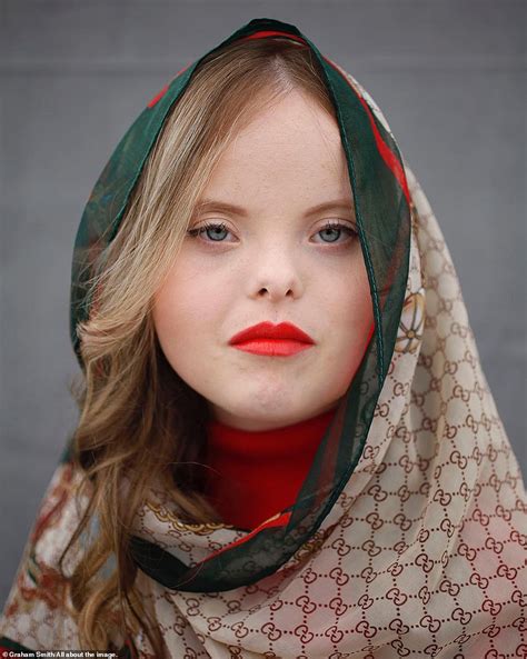 Model With Downs Syndrome Lands Contract With A Top Agency Daily Mail Online