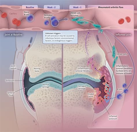 Types Of Risk In Software Testing