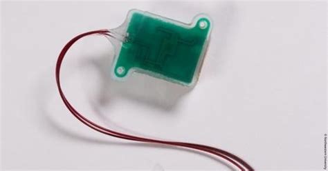 a wireless bladder monitoring device