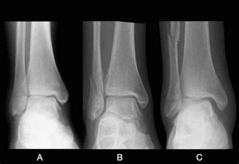 Robert Danis • Litfl • Medical Eponym Library