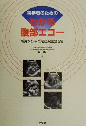 初学者のためのわかる腹部エコー 所見からみた超音波鑑別診断 中古本書籍 ブックオフ公式オンラインストア