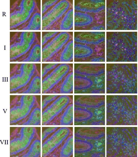 Pseudocolor Representation Of Normalization Results Column 1 To 4 Download Scientific Diagram