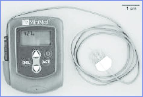 Continuous Glucose Monitoring System Cgms With Sensor Download Scientific Diagram
