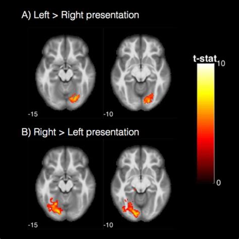 Visual Cortex Activity For Stimuli Presented On The Left Vs Right Of Download Scientific