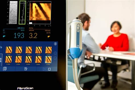 FibroScan Information For Patients Echosens