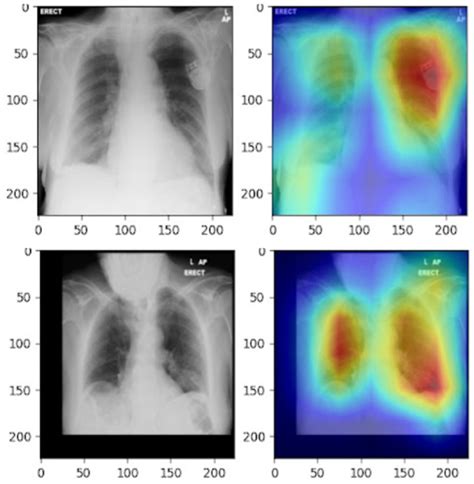 Representation Of Cnn Outputs On A Heat Map Using Grad Cam 33 The