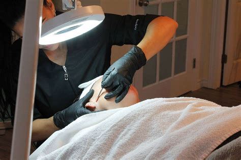 Microneedling Leverve Medi Spa