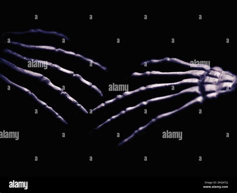 Close Up Of Two Hands In Skeleton Form With Some Parts Of Fingers