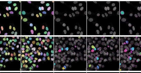 A Deep Learning Pipeline For Nucleus Segmentation Frederick National Laboratory
