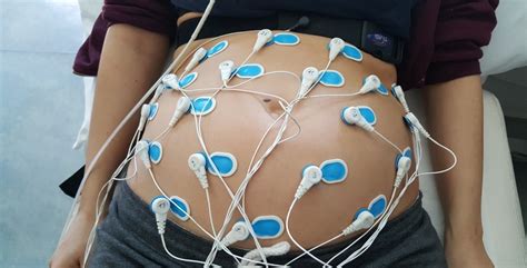 Non Invasive Fetal Electrocardiogram And Doppler In Early Pregnancy