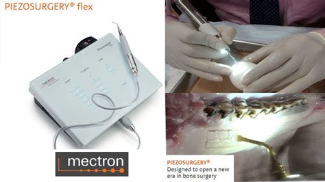 Piezoelectric Surgery Made Easy With Piezosurgery White By Mectron