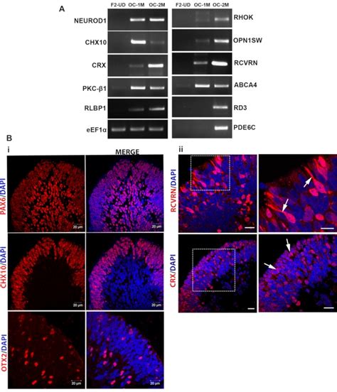 Generation Of Retinal Organoids From Healthy And Retinal Disease