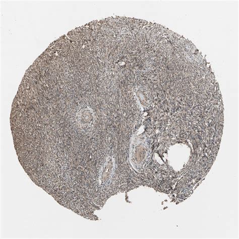 Tissue Expression Of Csf1r Staining In Ovary The Human Protein Atlas