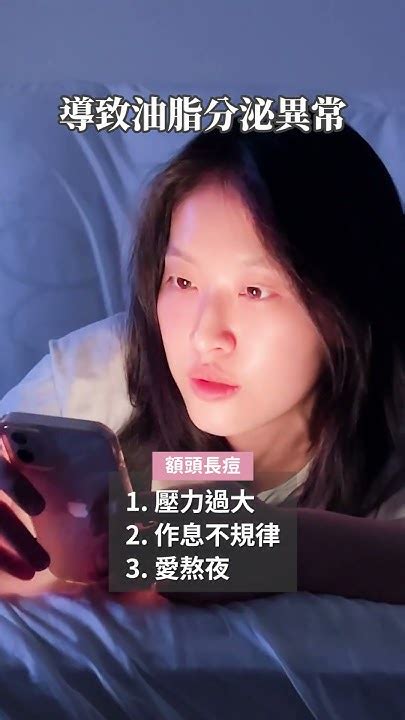 這三個日常細節一個不留神可能會讓你大爆痘😰 Youtube