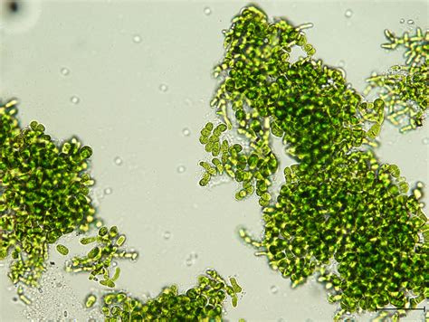 These Freeze Drying Algae Can Awaken From Cryostasis Could Help