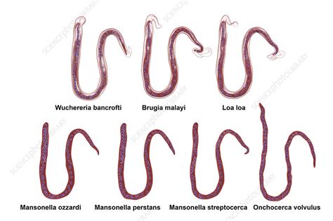 Comparison Of Microfilariae Morphology Illustration Stock Image F022 1869 Science Photo