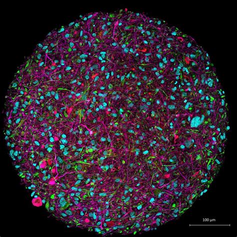 “organoid Intelligence” Revolutionary Biocomputers Powered By Human Brain Cells