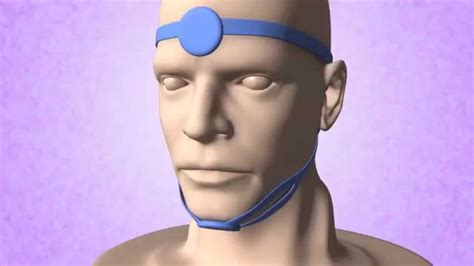 Direct Current Stimulation To Enhance Sex Drive Liberos LLC Patent YouTube