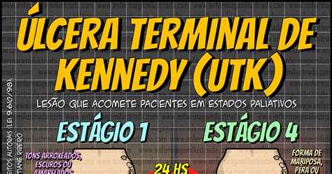 Úlcera Terminal De Kennedy Utk Enfermagem Ilustrada