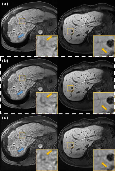 Figure 1 From Mr Image Denoising And Super Resolution Using Regularized