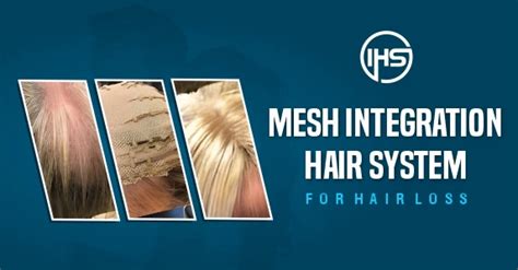 Mesh Integration Hair System Best Solution For Hair Loss