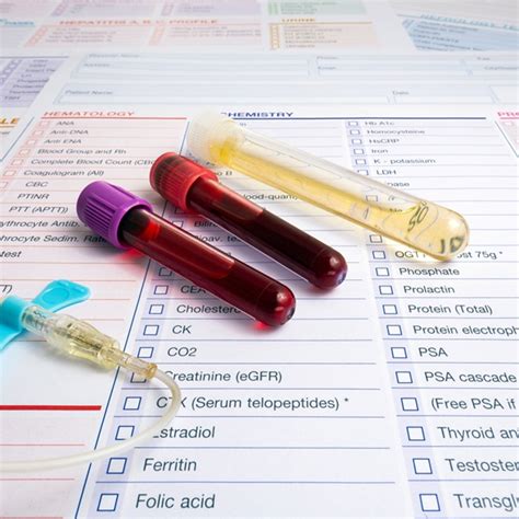 Cancer Marker Brain And Pituitary Gland Motherwit Lab Jaipur