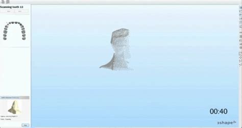 3shape Dental System Download The Most Powerful Cadcam Design 3shape Dental System Download The Most Powerful Cadcam Design