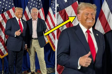 A Picture Of Donald Trumps Face Being Two Completely Different Colors