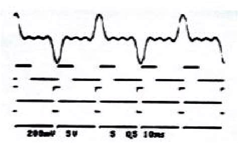 Load Angle Measurement Download Scientific Diagram