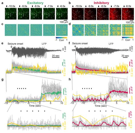 Neuronal Synchrony Of Excitatory And Inhibitory Activity A B