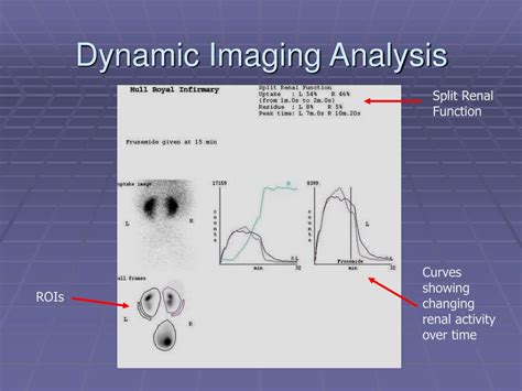 Renal Dynamic Imaging