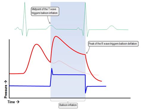 The Normal Iabp Waveform Deranged Physiology