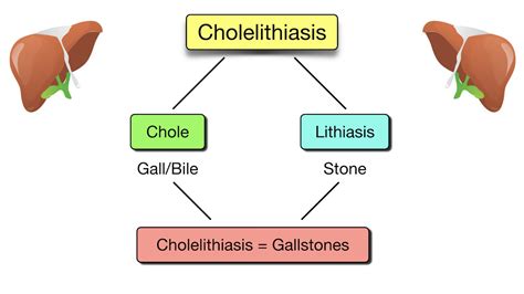 Choledocholithiasis Vs Cholelithiasis