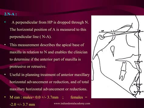 COGS Analysis Cephelometrics For Orthognathic Surgery Fixed Orthodontics Courses India PPT