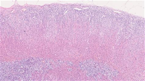 Adrenal Normal Histology Nus Pathweb Nus Pathweb