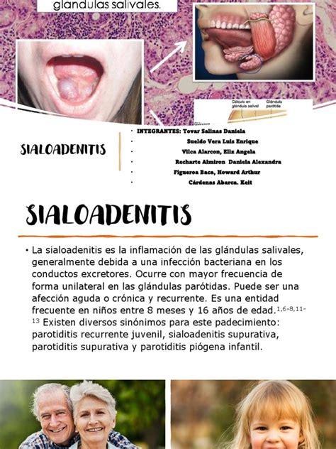 Sialoadenitis Pdf Ciencias De La Salud Especialidades Medicas