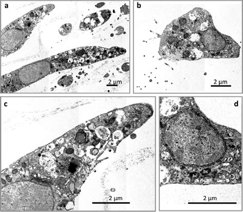 Morphological Characterization Of Sponge Cells And Endosymbiotic