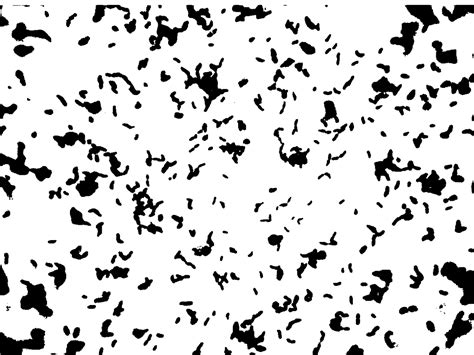 Bifidobacterium Bifidum And Application Thereof Eureka Patsnap