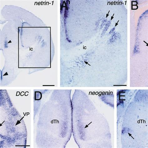Expression Of Netrin 1 And Netrin Receptors In Relation To The Tca Download Scientific Diagram