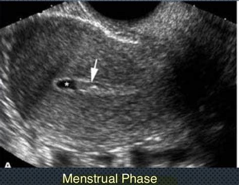 Female Reproduction Physiology Flashcards Quizlet