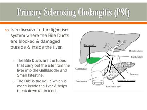 ppt primary sclerosing cholangitis psc powerpoint presentation id