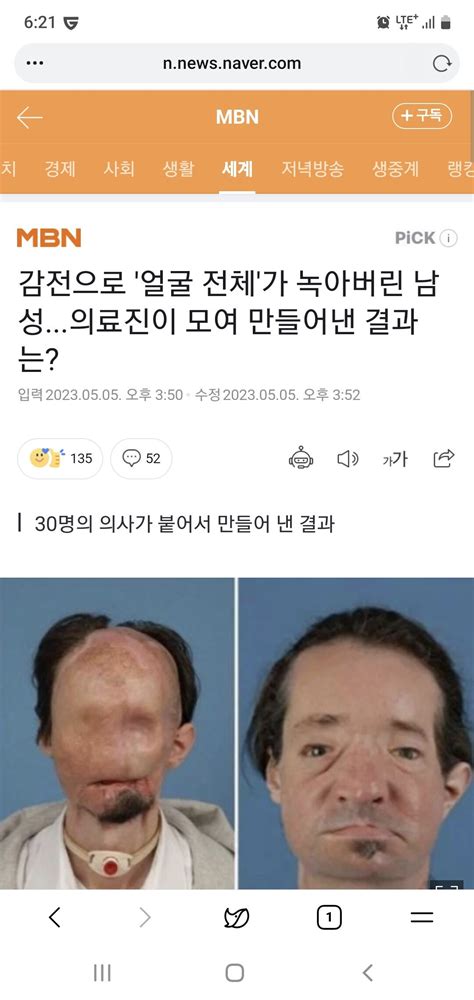 혐 현대 의료 기술의 놀라운 근황 포텐 터짐 최신순 에펨코리아