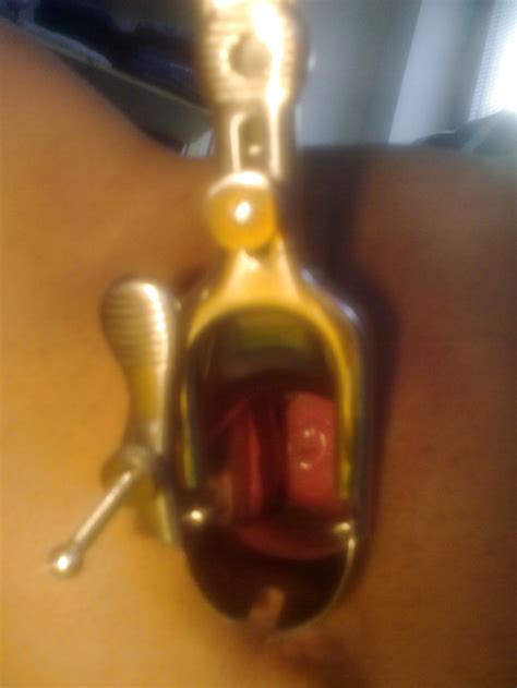 Cervix Porn Pics Pictoa