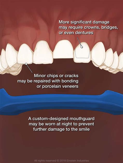 What Causes Teeth Grinding Medizzy