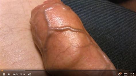 Juego De Prepucio Xhamster