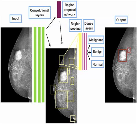 The Outline Of The Faster R Cnn Model For Cad In Mammography Download Scientific Diagram