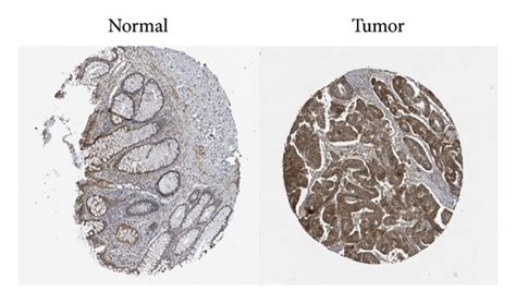 Smads Protein Levels In Crc Patients A Smad1 And B Smad2 Were Download Scientific Diagram