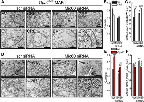 Mic60 And Opa1 Lie In The Same Genetic Pathway Controlling The Cj Download Scientific Diagram